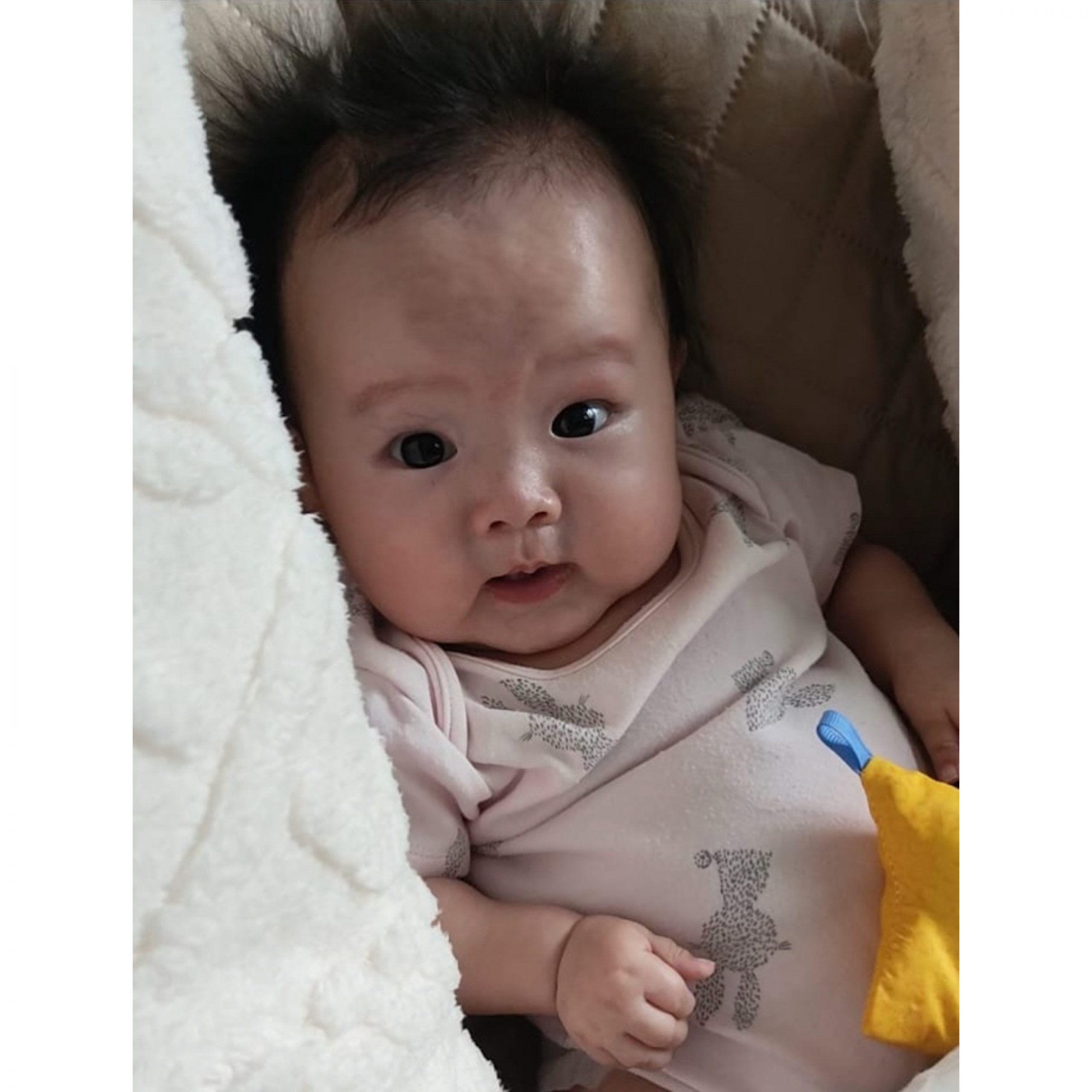 Baby Ginny Needs Life-Saving Treatment - RAY OF HOPE